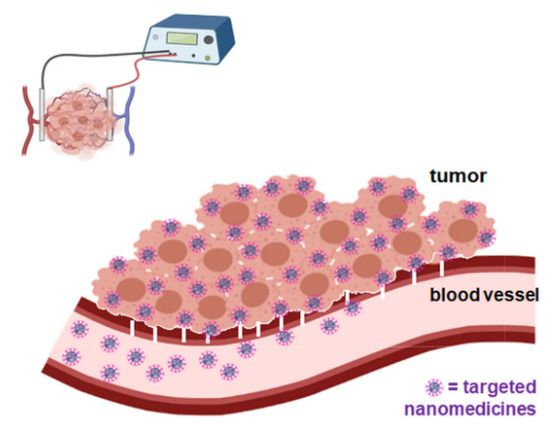 Electrochemotherapy of Deep-Seated Tumors: State of Art and ...