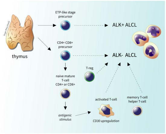 ALK-Negative Anaplastic Large Cell Lymphoma: Current Concepts and ...