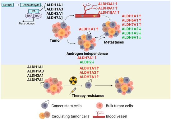 The Multifaceted Role of Aldehyde Dehydrogenases in Prostate Cancer ...
