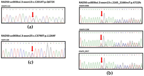 RAD50 Loss of Function Variants in the Zinc Hook Domain Associated with ...