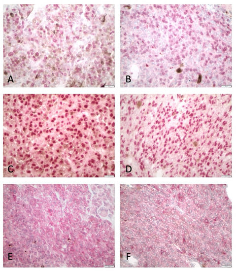 Cancers | Free Full-Text | Histone Deacetylase (HDAC)-1, -2, -4, and -6 ...