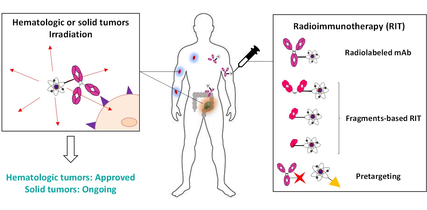 Cancers | Free Full-Text | Radioimmunotherapy in Oncology: Overview of ...