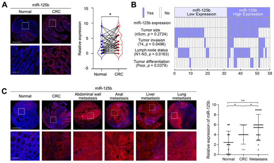 Cancers | Free Full-Text | miR-125b Promotes Colorectal Cancer ...
