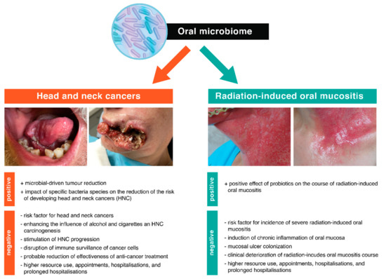Cancers | Free Full-Text | Is There an Interplay between Oral Microbiome, Head and Neck ...