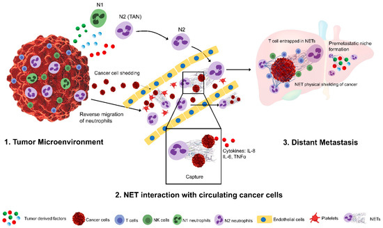 Neutrophil Extracellular Traps (NETs) in Cancer Metastasis