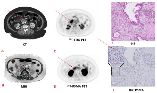 Molecular Targeted Positron Emission Tomography Imaging and ...