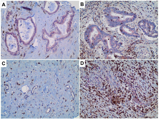 The Transmembrane Receptor TIRC7 Identifies a Distinct Subset of Immune Cells with Prognostic ...