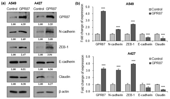 GPR87 Promotes Metastasis through the AKT-eNOS-NO Axis in Lung ...