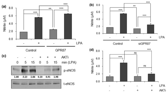 GPR87 Promotes Metastasis through the AKT-eNOS-NO Axis in Lung ...