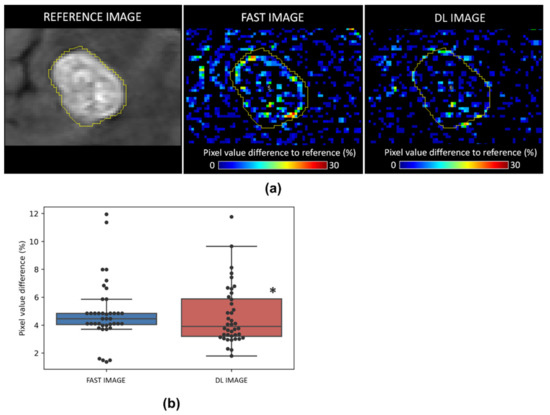 The Impact of Resampling and Denoising Deep Learning Algorithms on ...