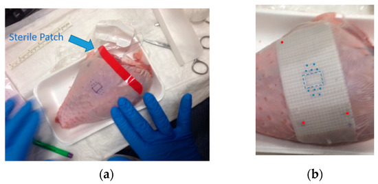 A New Approach for a Safe and Reproducible Seeds Positioning for ...
