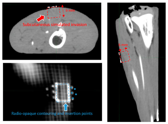 A New Approach for a Safe and Reproducible Seeds Positioning for ...