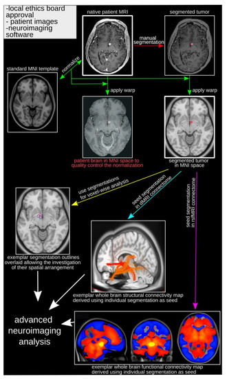Cancers | Free Full-Text | Untapped Neuroimaging Tools for Neuro ...