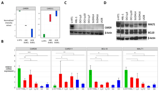 CARD9 Forms an Alternative CBM Complex in Richter Syndrome