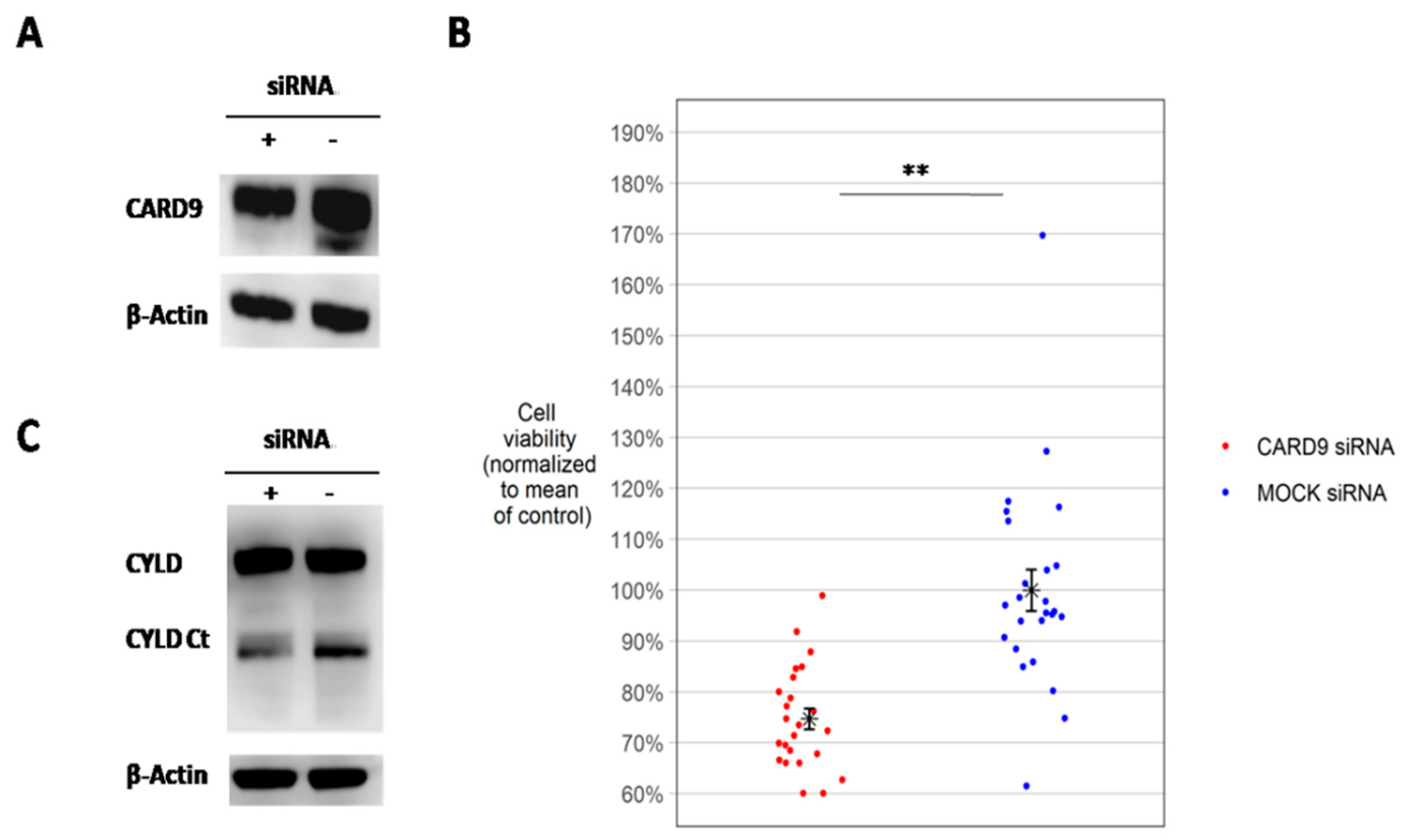 CARD9 Forms an Alternative CBM Complex in Richter Syndrome