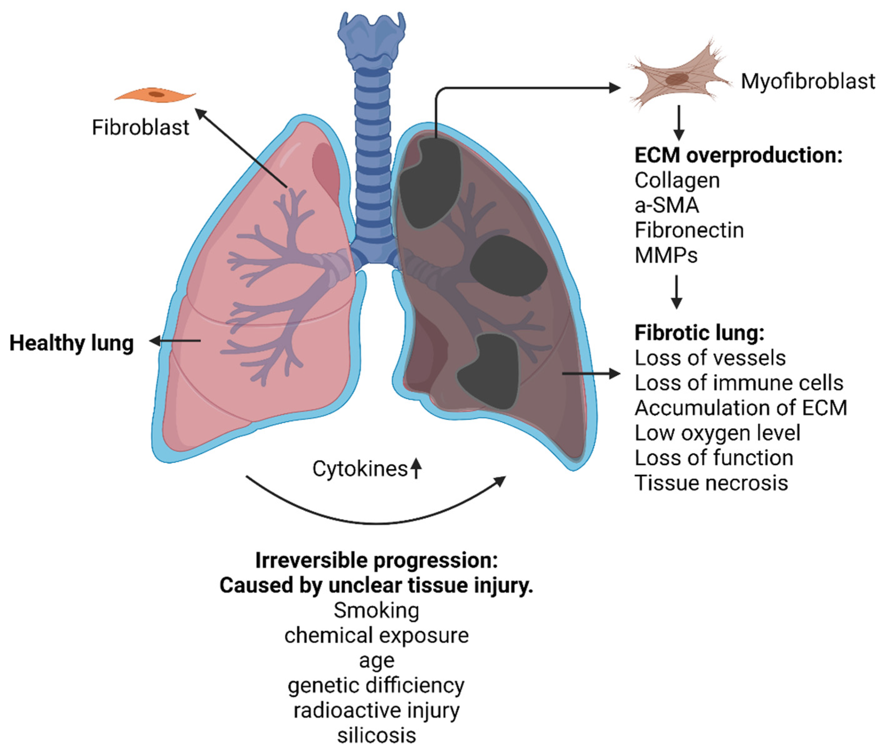 Inflammation, Fibrosis and Cancer: Mechanisms, Therapeutic Options and ...