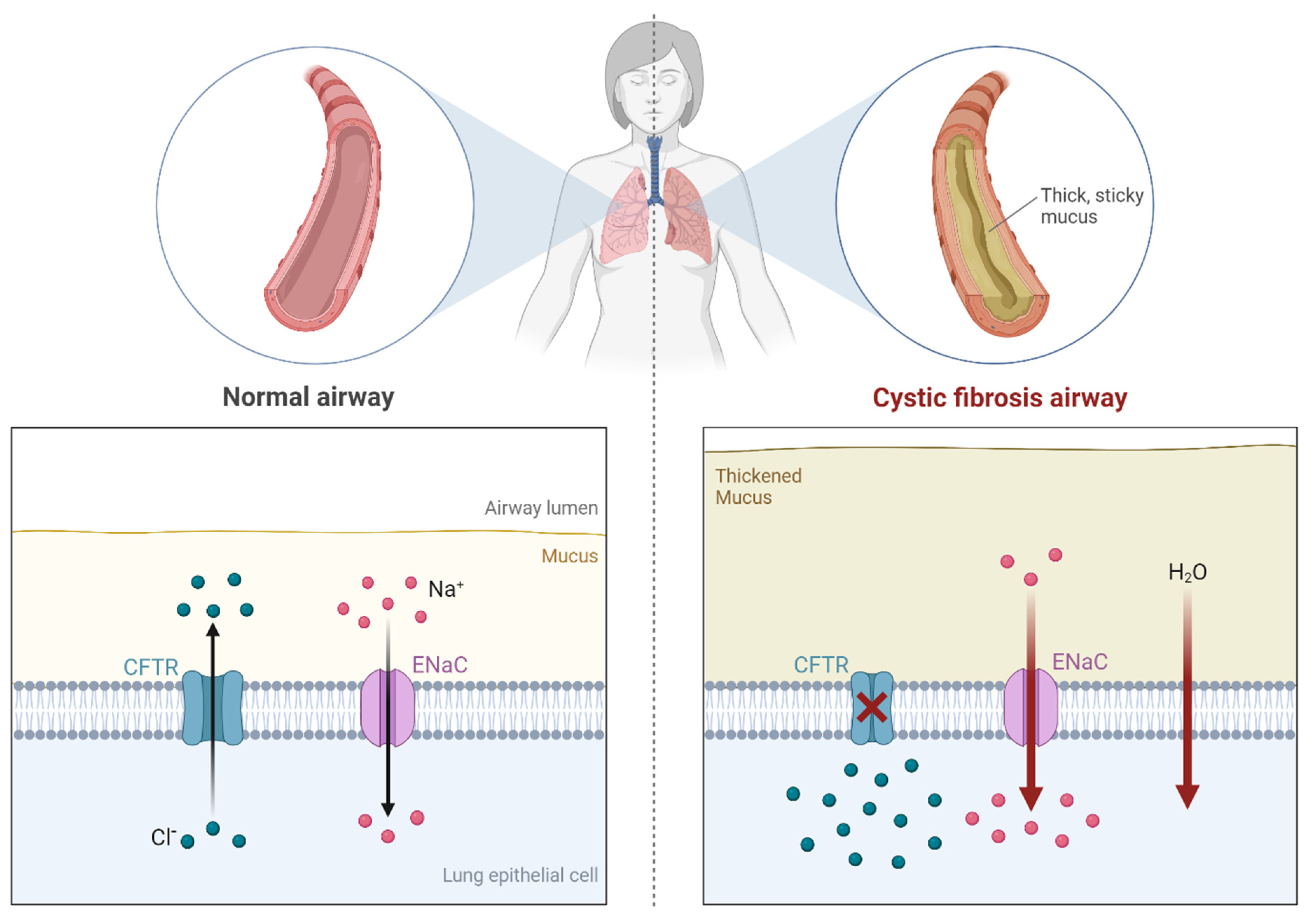 Inflammation, Fibrosis and Cancer: Mechanisms, Therapeutic Options and ...