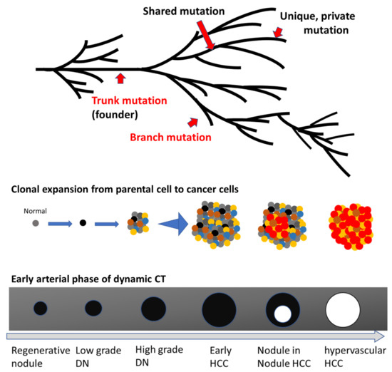 Genetic Landscape of Multistep Hepatocarcinogenesis