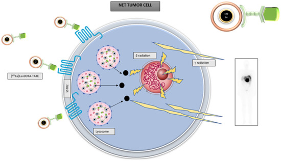 Peptide Receptor Radionuclide Therapy with [177Lu]Lu-DOTA-TATE in ...
