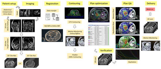 Cancers | Free Full-Text | MRI-Guided Online Adaptive Stereotactic Body Radiation Therapy of ...
