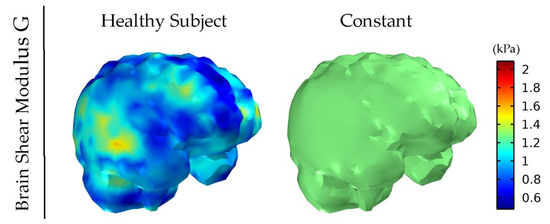 Inducing Biomechanical Heterogeneity in Brain Tumor Modeling by MR ...