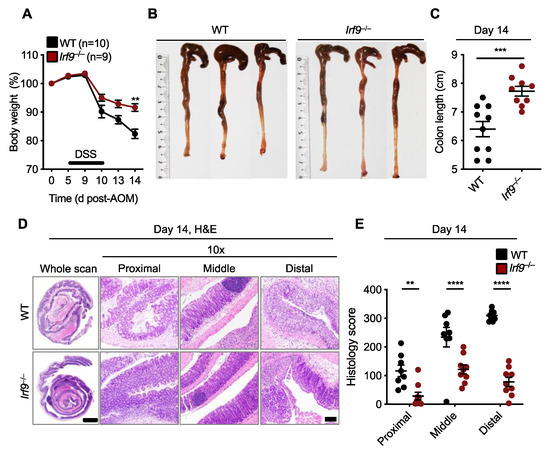 The Transcription Factor IRF9 Promotes Colorectal Cancer via Modulating ...