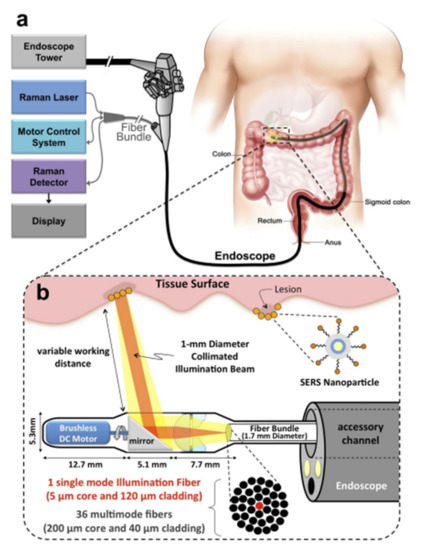 Raman Spectroscopy: A Personalized Decision-Making Tool on Clinicians ...