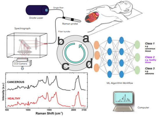Raman Spectroscopy: A Personalized Decision-Making Tool on Clinicians ...