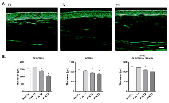 Paclitaxel Induces Epidermal Molecular Changes and Produces Subclinical ...