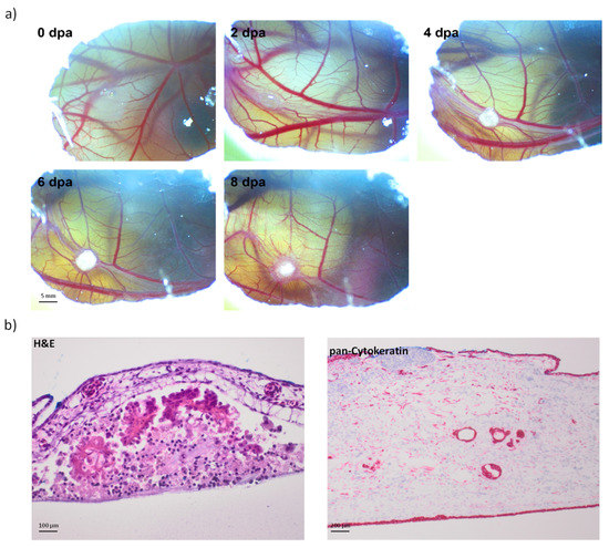 Chick Chorioallantoic Membrane (CAM) Assays as a Model of Patient ...