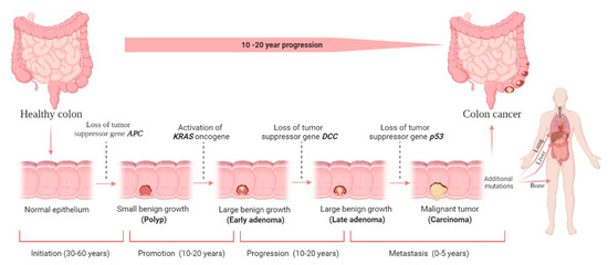 Colorectal Cancer: A Review of Carcinogenesis, Global Epidemiology ...