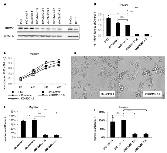 Histone Demethylase KDM5C Drives Prostate Cancer Progression by ...