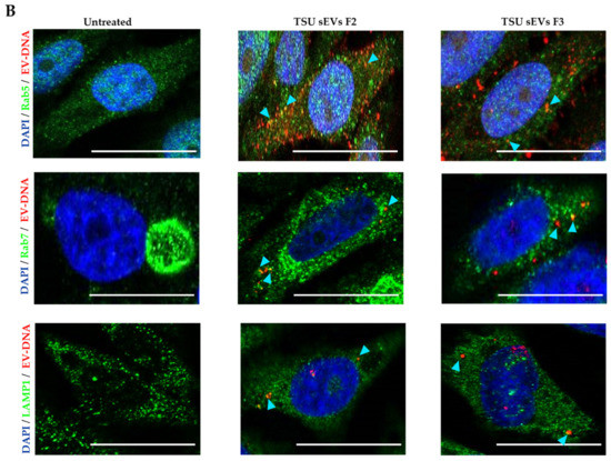 Efficient Small Extracellular Vesicles (EV) Isolation Method and ...