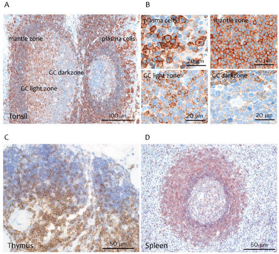Cancers | Free Full-Text | CD229 (Ly9) a Novel Biomarker for B-Cell ...