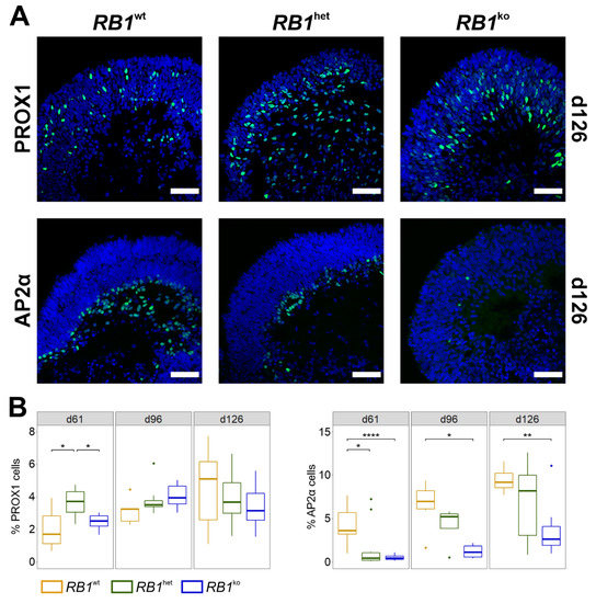 RB1-Negative Retinal Organoids Display Proliferation of Cone ...