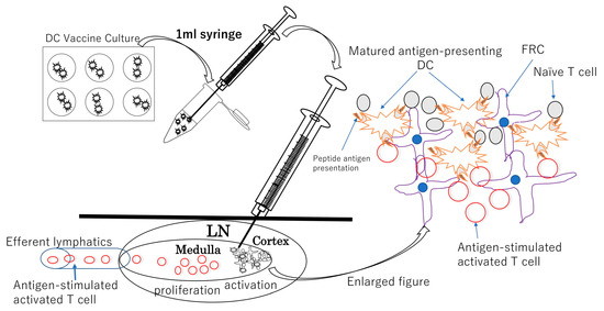 Cancers | Free Full-Text | Lymph Nodes as Anti-Tumor Immunotherapeutic ...