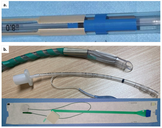 Optimal Monitoring Technology for Pediatric Thyroidectomy