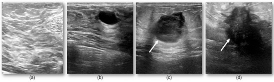 Dual-Intended Deep Learning Model for Breast Cancer Diagnosis in ...