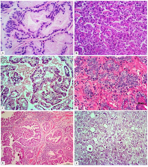 Comparative Pathobiology of Canine and Human Prostate Cancer: State of ...