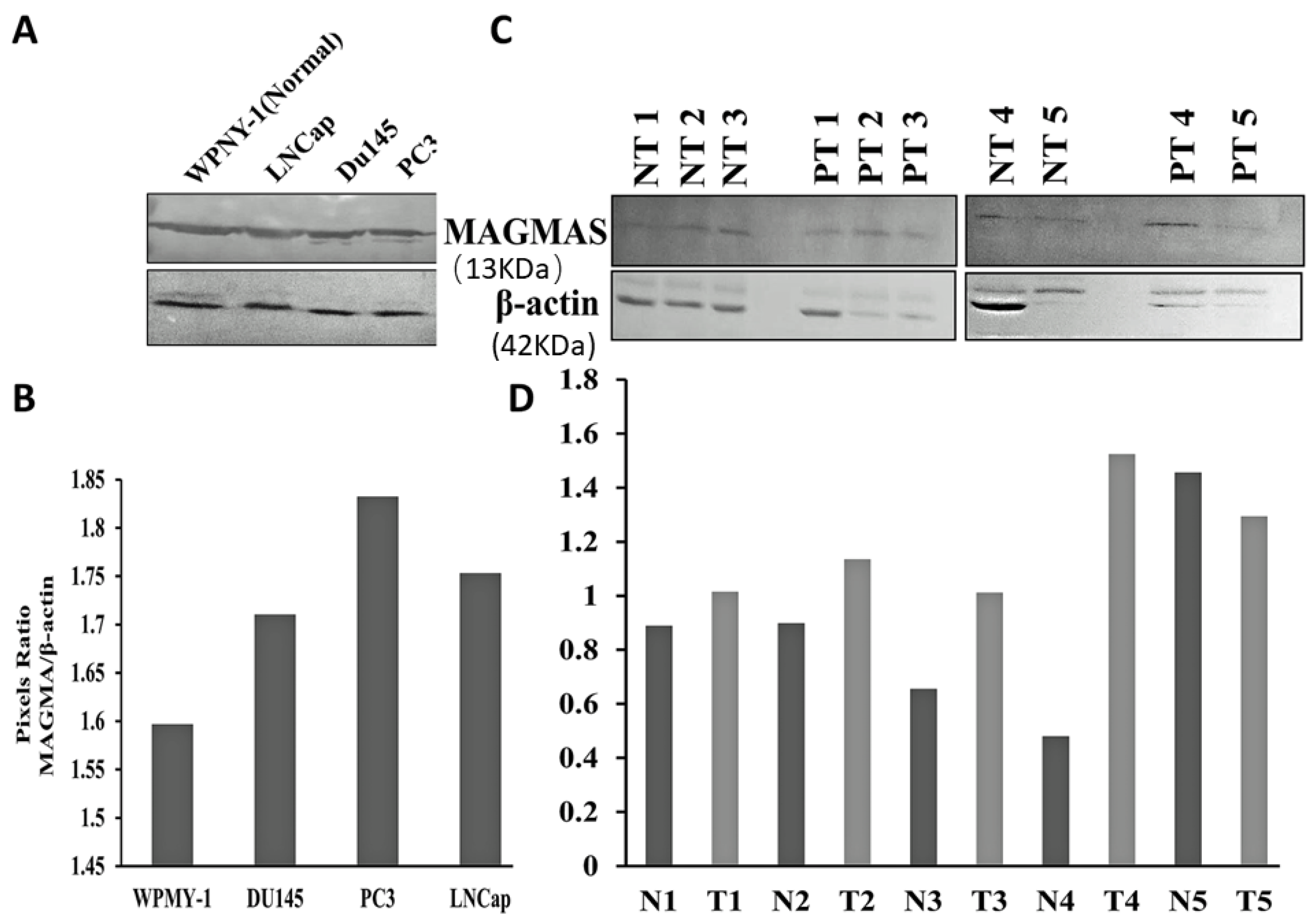 Cancers | Free Full-Text | Magmas Inhibition in Prostate Cancer: A ...