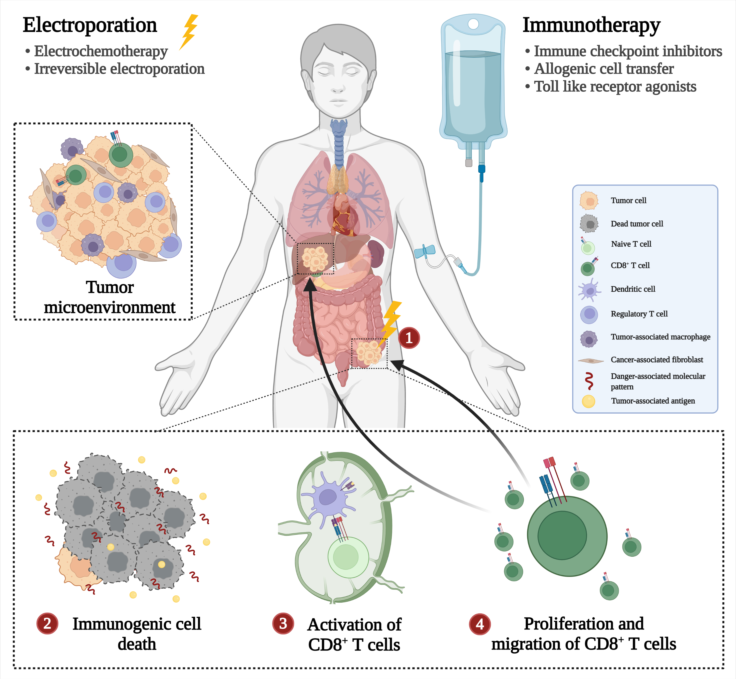 Cancers | Free Full-Text | Electroporation and Immunotherapy—Unleashing ...