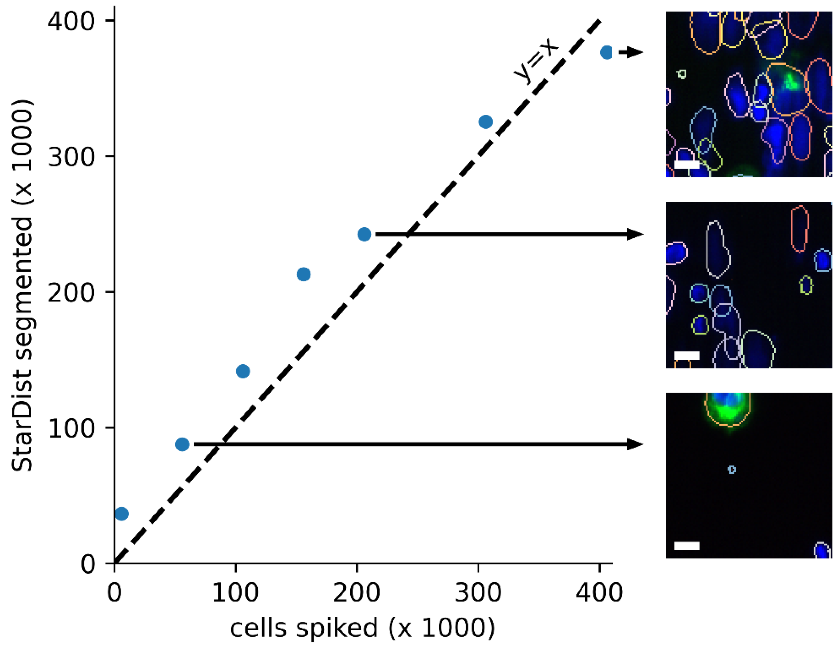 StarDist Image Segmentation Improves Circulating Tumor Cell Detection