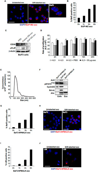 ALK+ Anaplastic Large Cell Lymphoma (ALCL)-Derived Exosomes Carry ALK ...