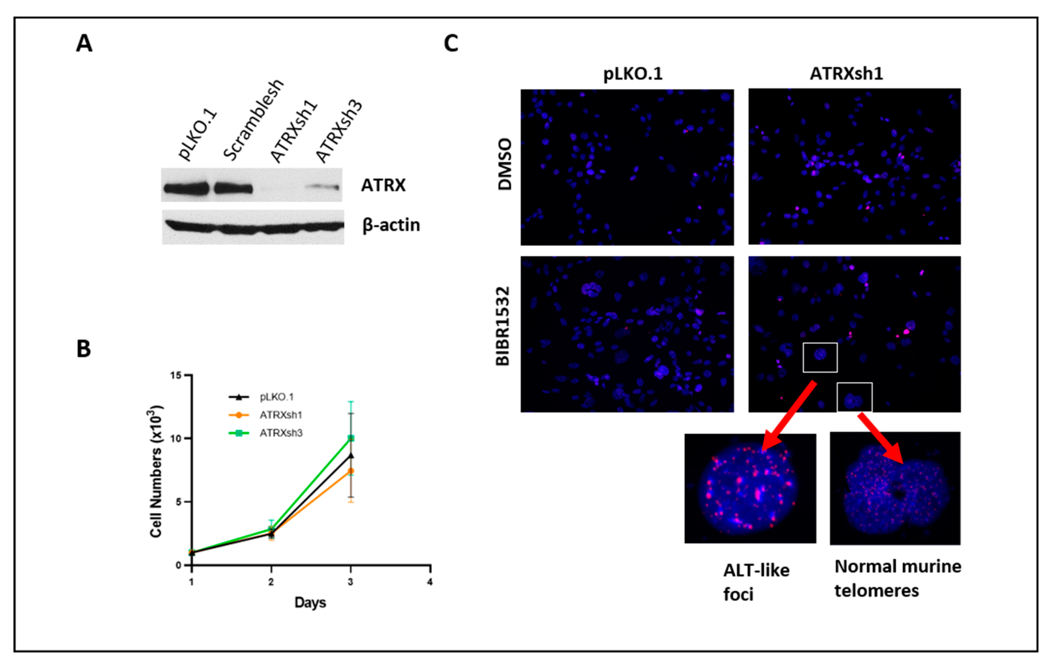 Therapeutic Vulnerability to ATR Inhibition in Concurrent NF1 and ATRX ...