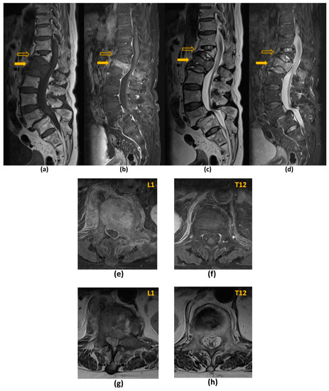 Cancers | Free Full-Text | State-of-the-Art Imaging Techniques in ...