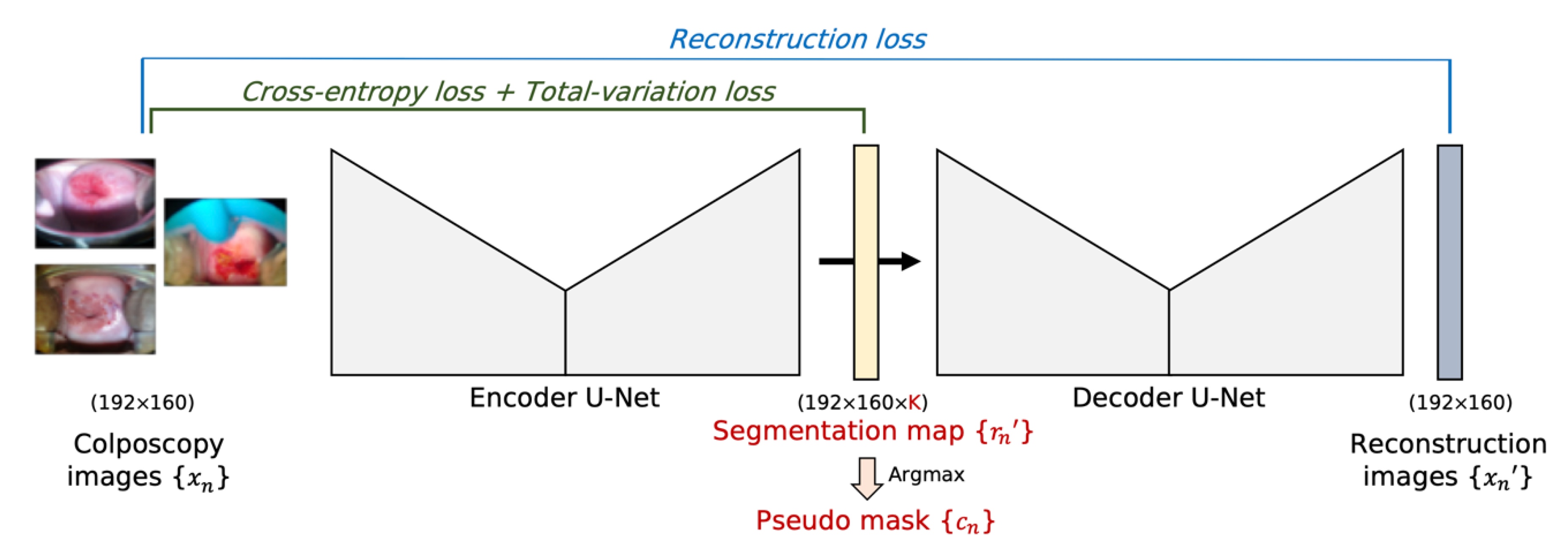 Cancers | Free Full-Text | Encoder-Weighted W-Net for Unsupervised Segmentation of Cervix Region ...