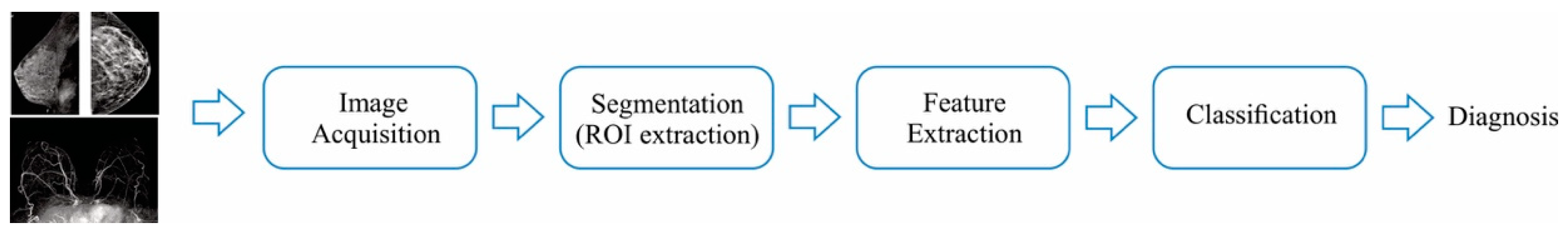 Diagnostic Strategies for Breast Cancer Detection: From Image ...