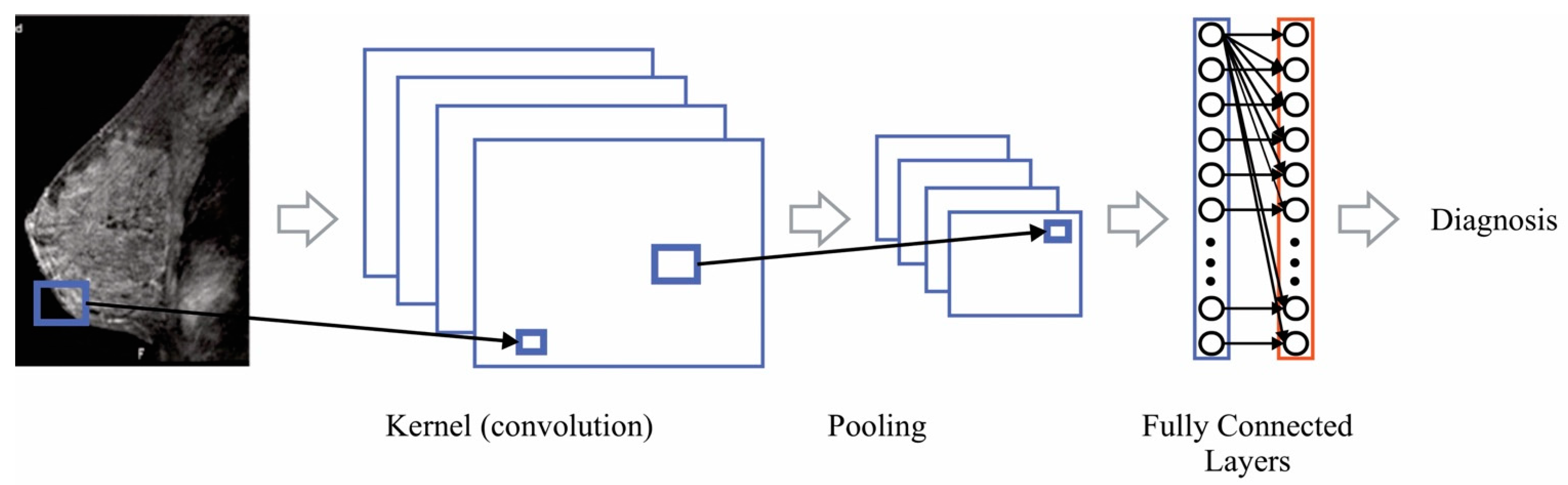 Diagnostic Strategies for Breast Cancer Detection: From Image ...