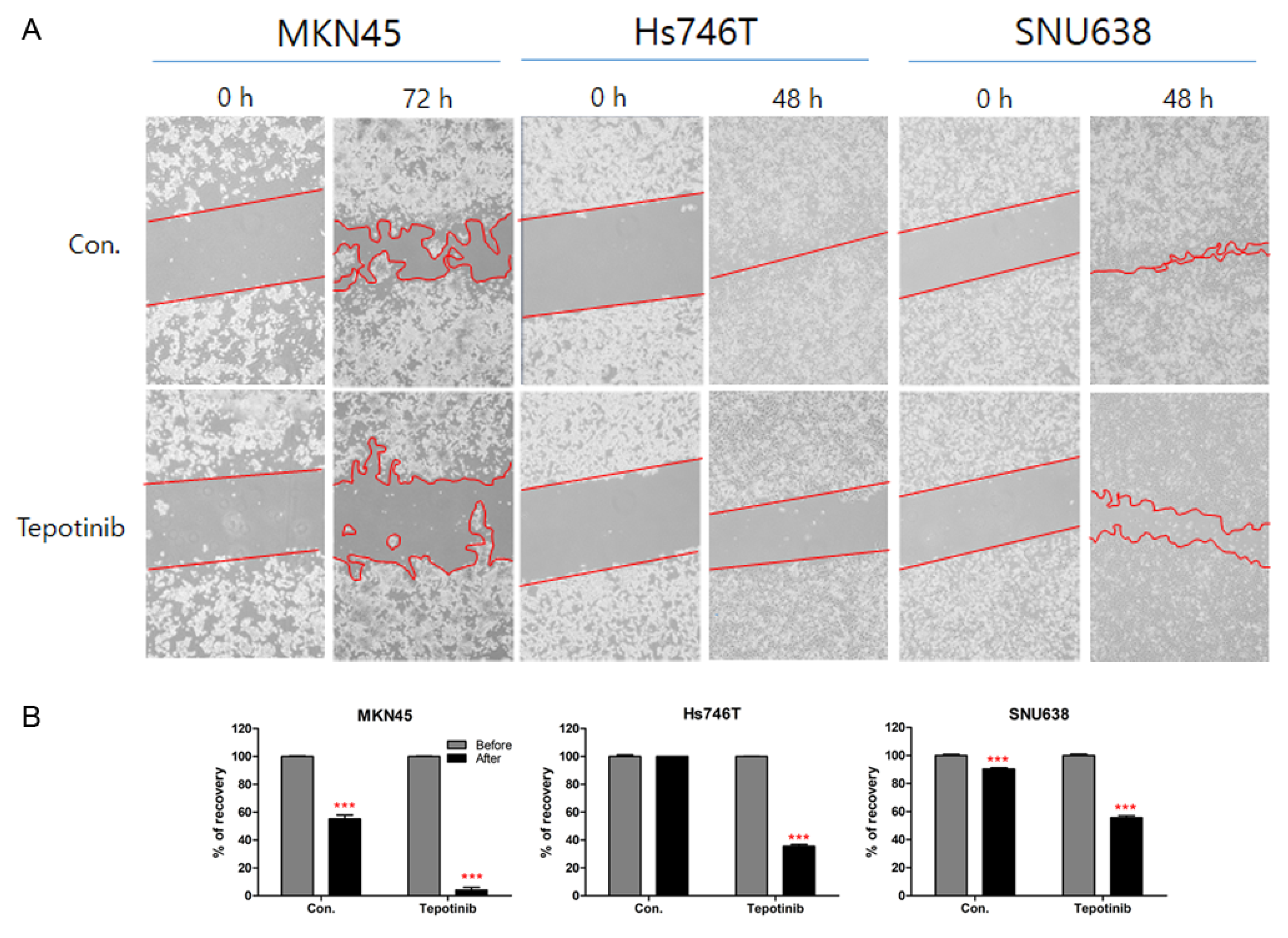 Responses to the Tepotinib in Gastric Cancers with MET Amplification or ...