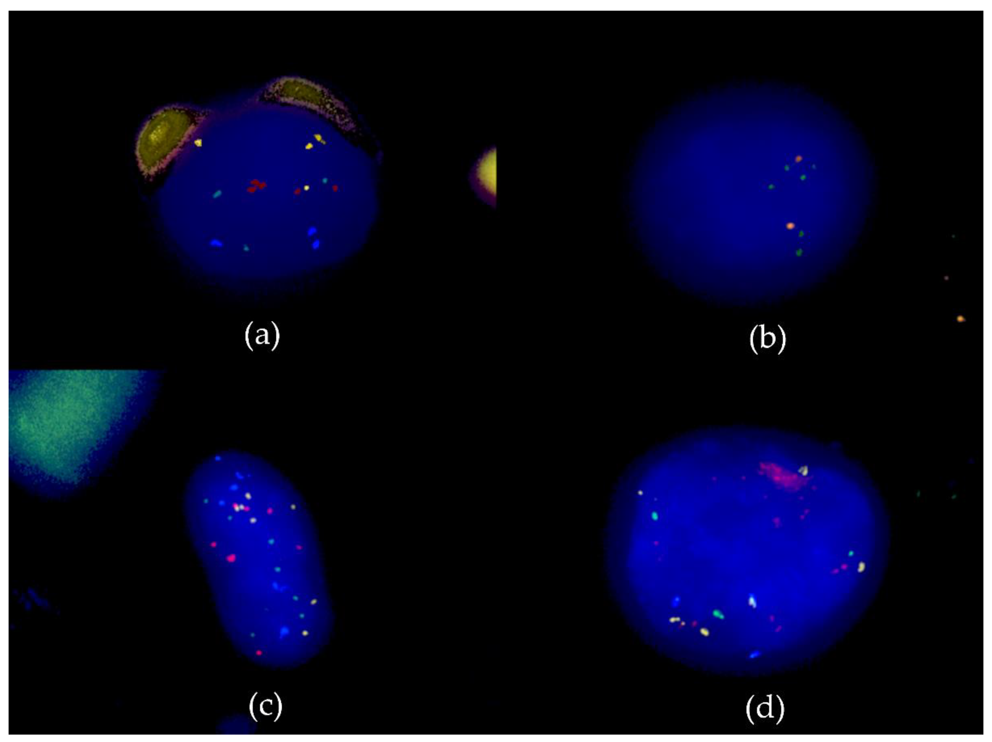 A New Multi-Color FISH Assay for Brush Biopsy-Based Detection of ...